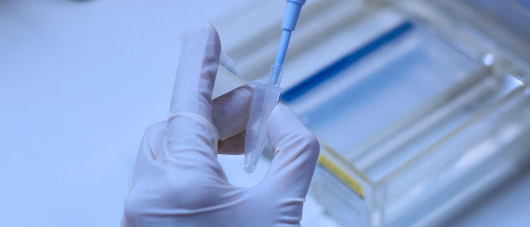 Tipos de electrofóresis, ¿cuales existen?|Cesur FP®